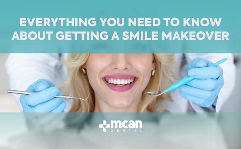 Everything You Need to Know About Getting a Smile Makeover - MCAN Dental